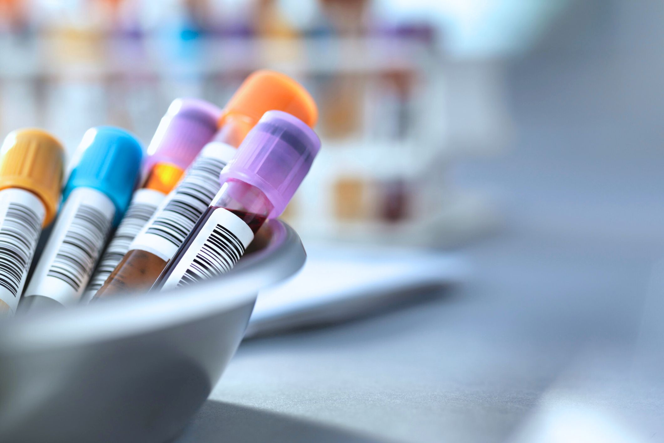 Functional Lab Testing at Hang 10 Drips